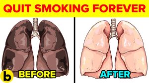 8 Easy Ways To Finally Quit Smoking Forever – Freedom-From-Smoking.com